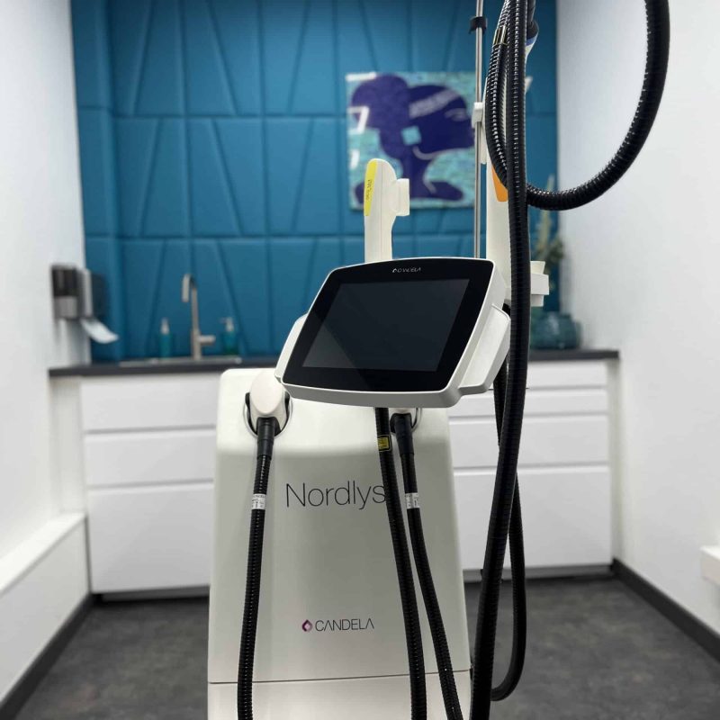 L'angiome stellaire - Centre Esthétique et Laser Gramont